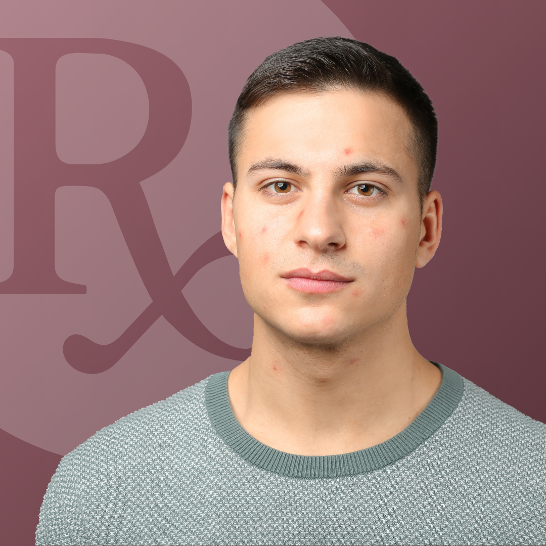 Understanding Acne: How SKNV Medications Can Help | SKNV